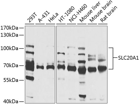 SLC20A1 Polyclonal Antibody | APR25411N | Leading Biology | Leading ...