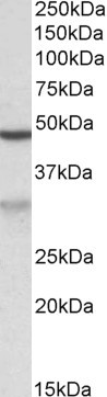 MOB2 (aa128-140) Antibody (internal region) | APG00751G | Leading ...
