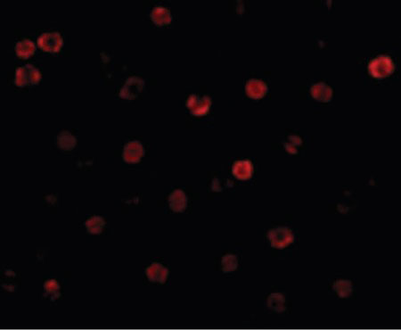 CDH13 / Cadherin 13 Antibody (N-Terminus) | APR02248G | Leading Biology ...