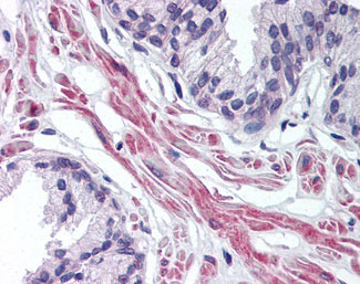 PTAR2 / FNTA Antibody (aa150-250) | APR02433G | Leading Biology ...