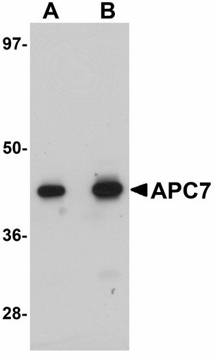 ANAPC7 / APC7 Antibody (C-Terminus) | APR02656G | Leading Biology ...