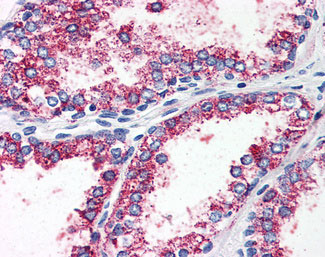 HTR2A / 5-HT2A Receptor Antibody (N-Terminus) | APR07853G | Leading ...