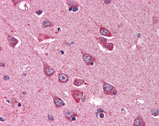 PTPRT Antibody (Internal) | AMM07417G | Leading Biology | Leading ...