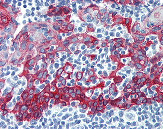 KRT5 / CK5 / Cytokeratin 5 Antibody (C-Terminus) | APR17112G | Leading ...