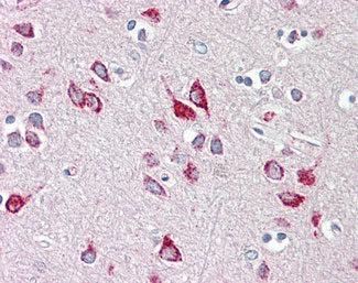 HEXB Antibody (aa481-530) | AMM05334G | Leading Biology | Leading ...