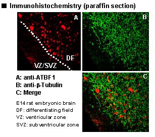 ZFHX3 / ATBF1 Antibody | APR14023G | Leading Biology | Leading Biology Inc.