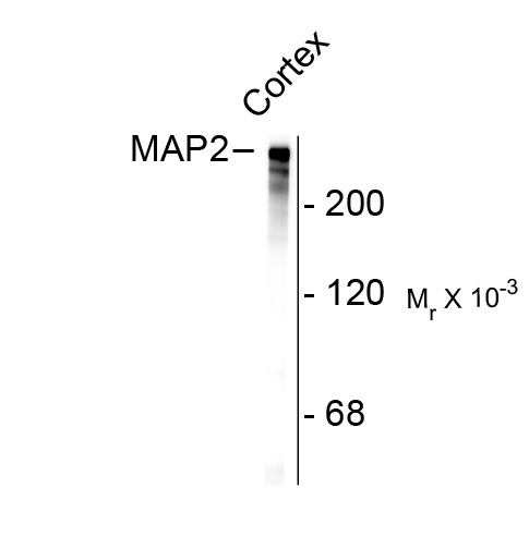 Microtubule Associated Protein 2 (MAP2) Antibody | AMM06395G | Leading ...