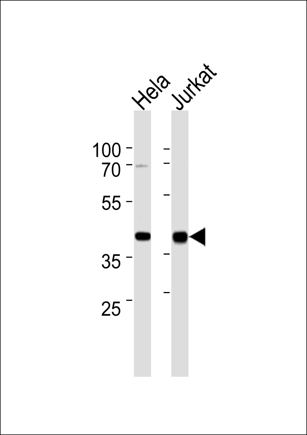 MAPK3 Antibody | APR17299G | Leading Biology | Leading Biology Inc.