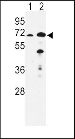 EHHADH Antibody (C-term) | APR07649G | Leading Biology | Leading ...