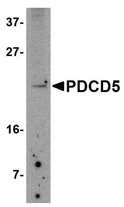 PDCD5 Antibody | APR08984G | Leading Biology | Leading Biology Inc.