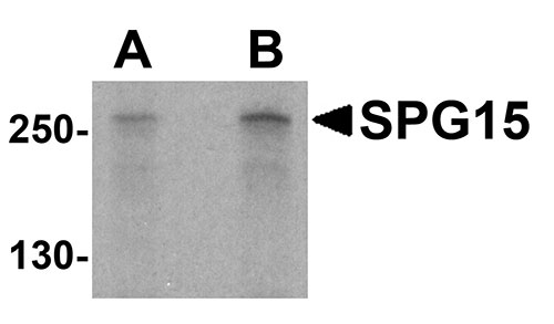 SPG15 Antibody | APR13505G | Leading Biology | Leading Biology Inc.