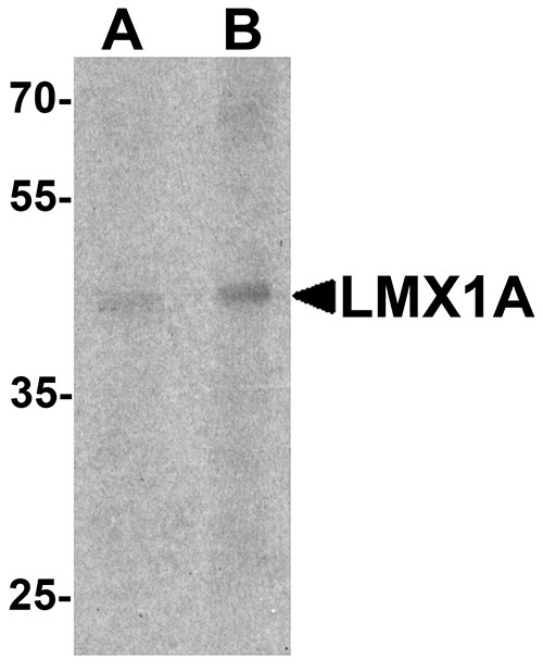LMX1A Antibody | AMM06314G | Leading Biology | Leading Biology Inc.