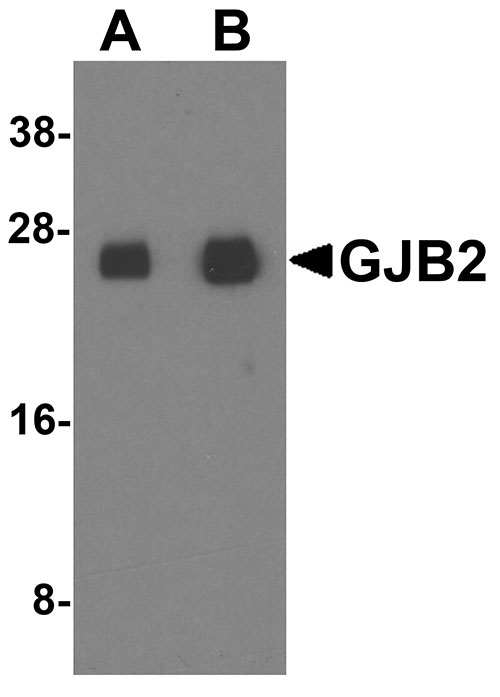 GJB2 Antibody | APR12028G | Leading Biology | Leading Biology Inc.